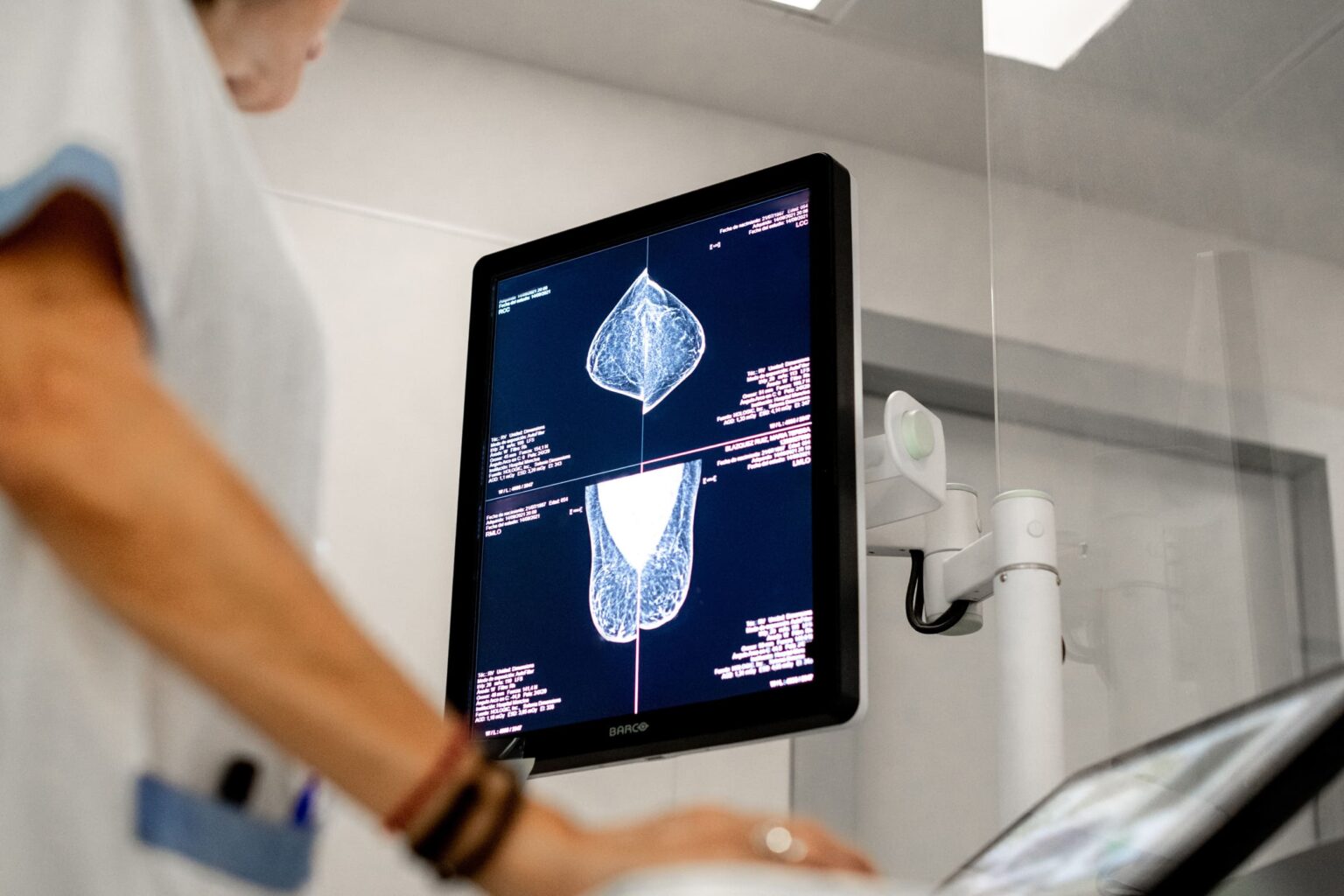 ¿Cómo se realiza una biopsia de mama? | Centro de Diagnóstico